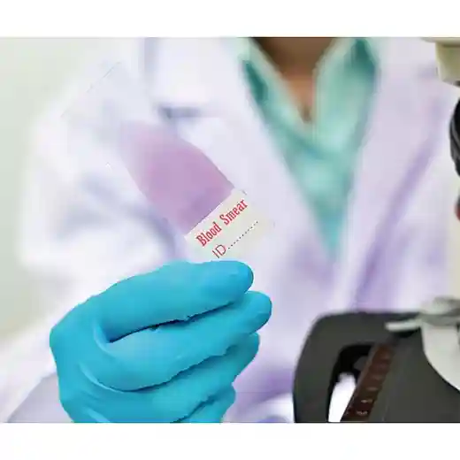 RM7310A Automatic Blood Smear Microscope Slides-Automatic Blood Smear ...